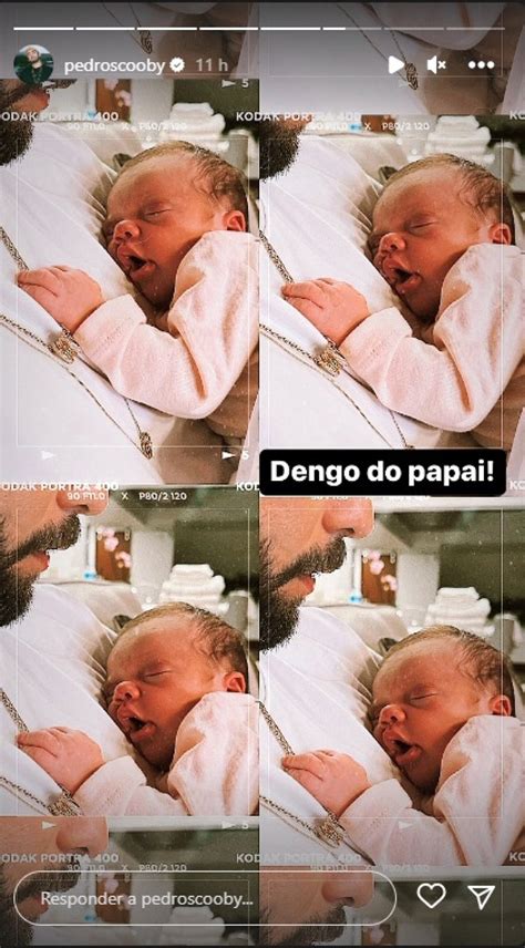 QUAL A DOENÇA DA FILHA DE PEDRO SCOOBY Entenda o que tem Aurora filha