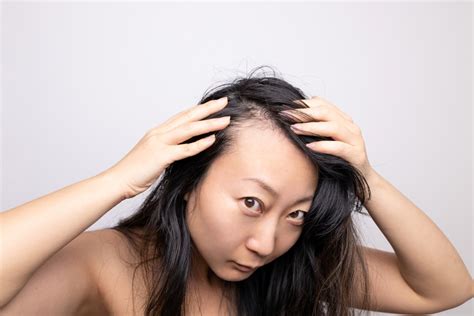Know The Difference Fut Vs Fue Hair Transplant Treatment