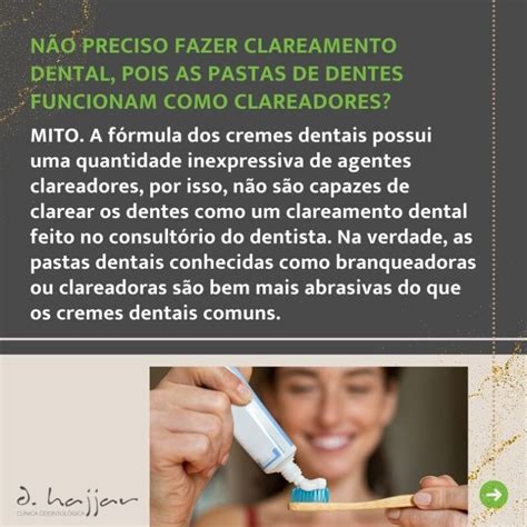 Mitos Do Clareamento Dental Que Voc Deve Conhecer