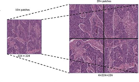figure 1 from a dual branch self supervised representation learning framework for tumour