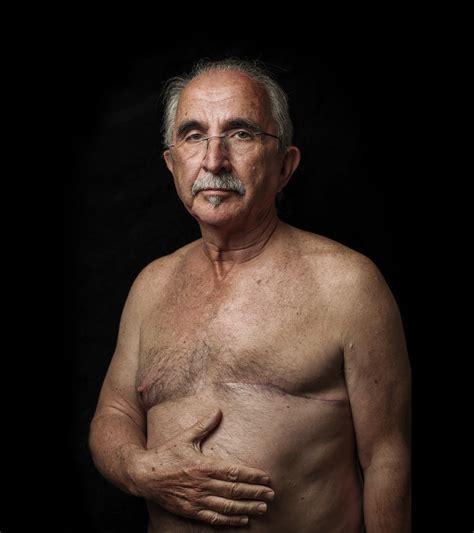 Las cicatrices invisibles del cáncer de mama en hombres por qué un 80