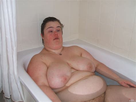 Mentally Retarded Photos Sex And Porn