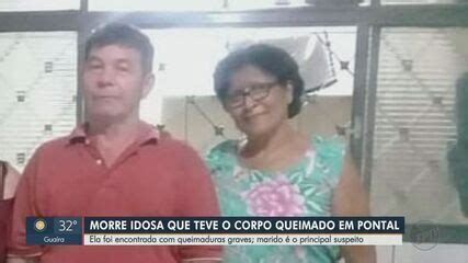 Morre Idosa Que Teve Mais Da Metade Do Corpo Queimado Em Pontal SP