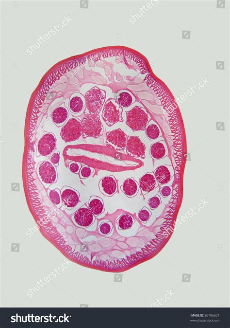 Ascaris Lumbricoides Male And Female Cross Section