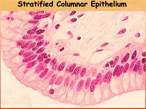 Stratified Squamous Epithelium Slide Labeled