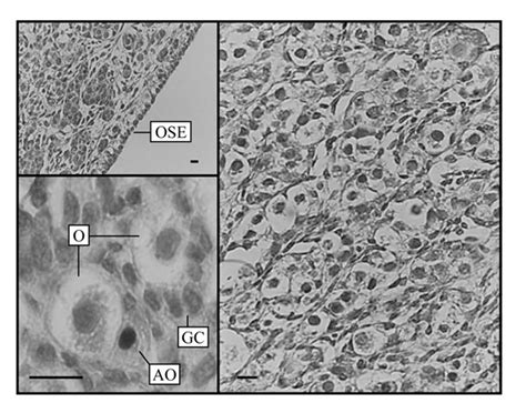 Light Microscopic Morphology Of Fetal Ovaries A Low Power View Of The