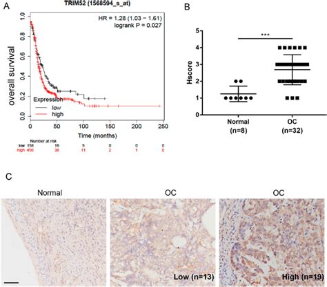 High Level Of TRIM52 Expression Predicts Poor Prognosis A KM Plot