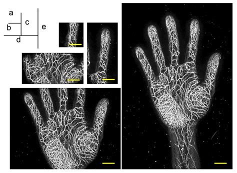 real time 3d photoacoustic visualization system f1000research