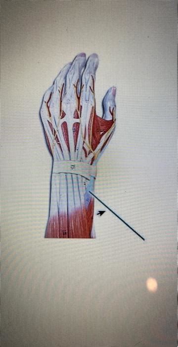 Solved What Muscle Is Highlighted Chegg