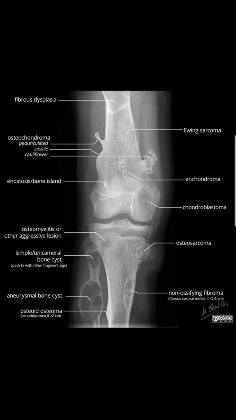 Mri Spine Anatomy Free Mri Lumbar Spine Sagittal Cross Sectional