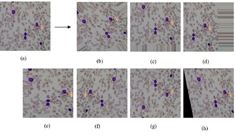 figure 2 from identification of leukemia subtypes from microscopic images using convolutional