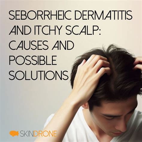 Seborrheic Dermatitis And Itchy Scalp Causes And Possible Solutions