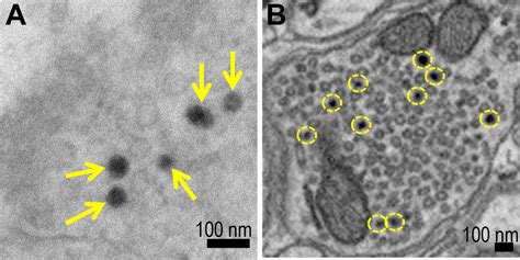Neuron Synapse Microscope