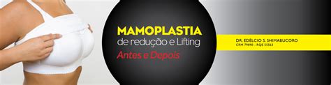 Mamoplastia Redutora Antes E Depois Fotos Alpinemoms