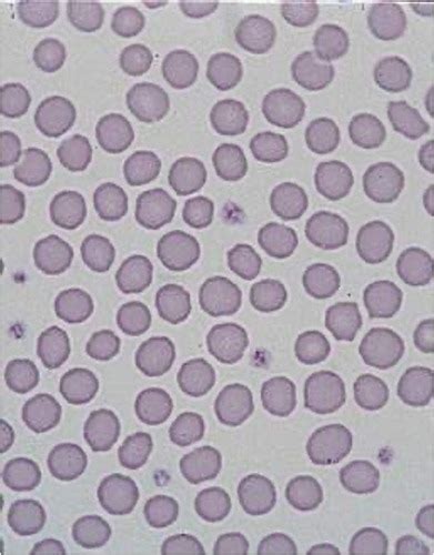 Clin Path Lab Hematology Identification Flashcards Quizlet