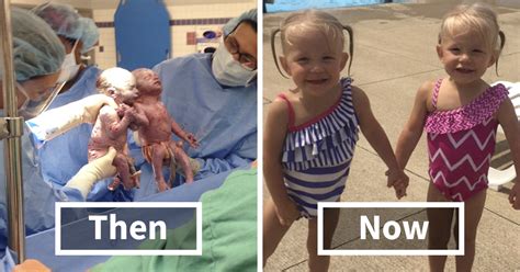 Twins Born Holding Hands 2 Years Ago Are Now Closer Than Ever Bored Panda