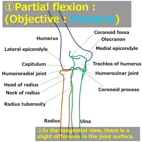 Elbow Ap View Alternate Partial Flexion Tangential View Tools For