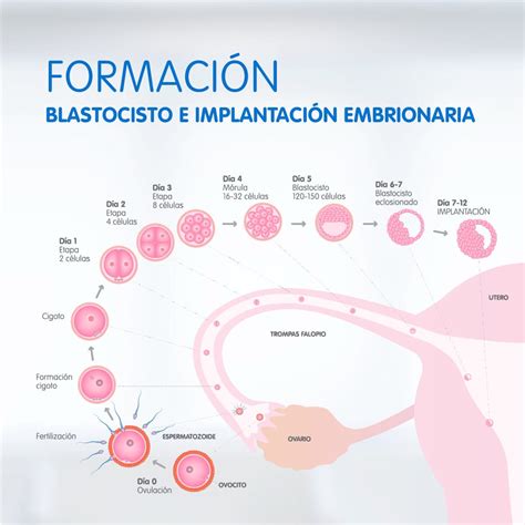 Sangrado de Implantación todo lo que deberías saber IVI Blog