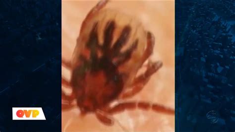 Mais Duas Mortes Por Febre Maculosa Na Bahia YouTube