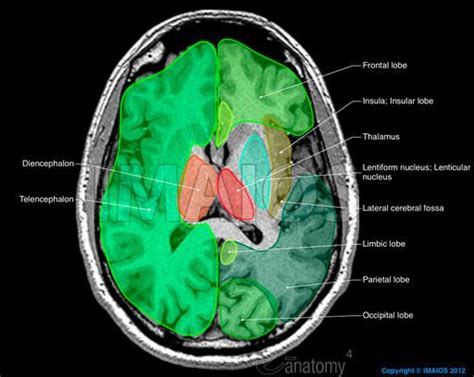 Brain Lobe Anatomy Mri