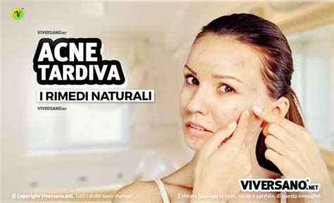 Acne Tardiva Rimedi Naturali Efficaci Per L Acne In Et Adulta