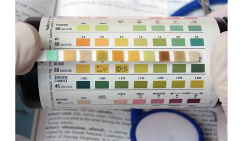 L Quilibre Acide Basique Un Levier Potentiel Contre Le Cancer