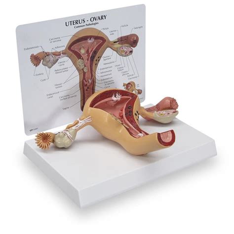 Modèle anatomique d utérus SB35435 Nasco Heathcare