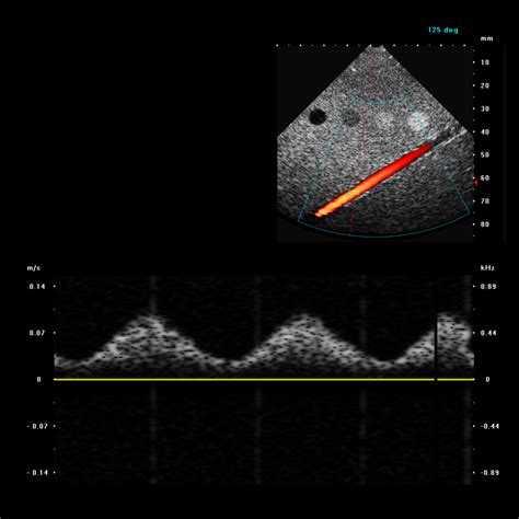 Pulsed Wave PW Doppler Mode Scintica