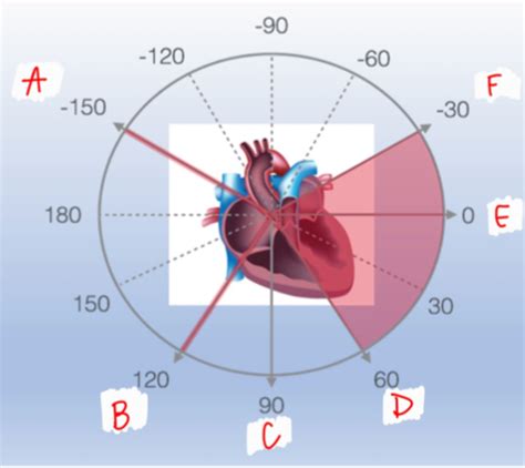 Ekg Flashcards Quizlet