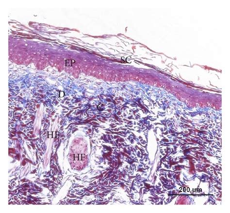 Histological Sections From The Wound Area Stained With Trichrome