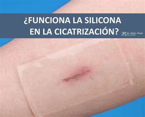 Funciona la silicona en la cicatrización Dr Adrián Alegre Sánchez