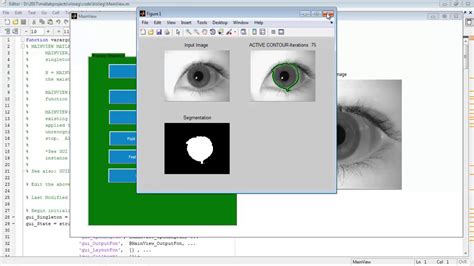 matlab code for edge detection techniques for image s