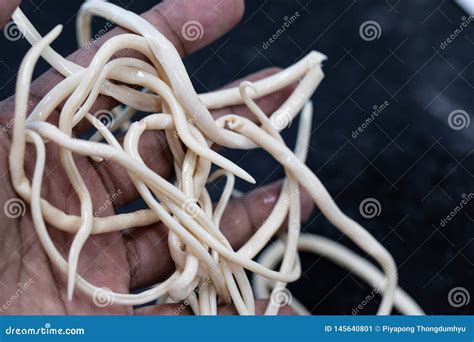 Scariasis Is A Disease Caused By The Parasitic Roundworm Ascaris