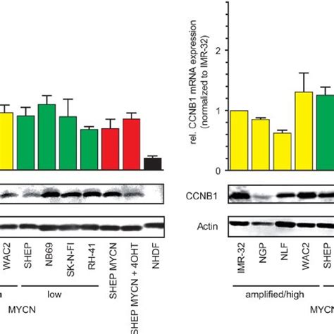 Ccnb And Cdk Mrna Expression Correlate With A Poor Outcome And Mycn