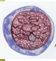 Hematology Combined Rbc Flashcards Flashcards Quizlet