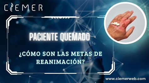 Metas de reanimación en pacientes quemados cómo lo debo abordar en