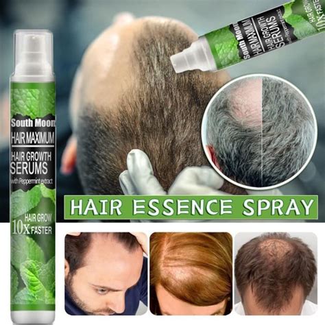 Spray pour la croissance des cheveux prévenir la perte de cheveux