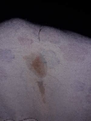Corrimento marrom escuro depois da Menstruação BabyCenter