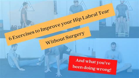 6 Exercises To Improve Your Hip Labral Tear Without Surgery YouTube