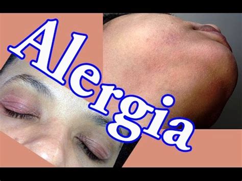 TÔ ALERGIA A MAQUIAGEM YouTube