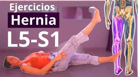 Tres Aspectos Clave Sobre La Hernia Discal L5 S1 Ejercicios Prohibidos