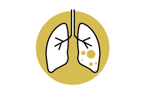 Lung Cancer Screening CT Naperville Radiologists