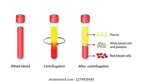 Blood Centrifugation Platelets Red Blood Erythrocytes Stock Vector