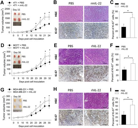 IL 22 Promotes Tumor Growth Of Breast Cancer Cells In Mice Figure F1
