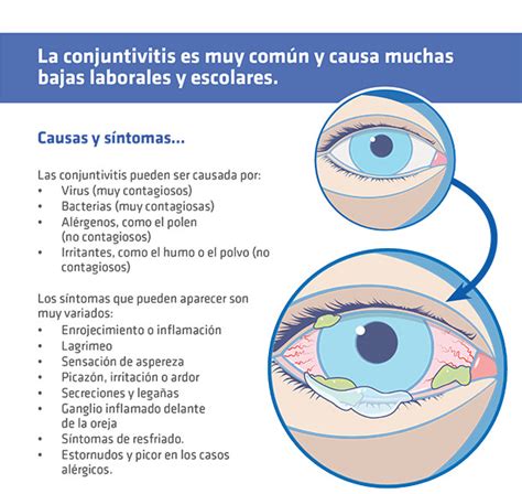 Como Se Contagia La Conjuntivitis