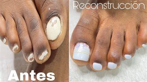Reconstruccion de uñas de pies con polygel acripie desde el principio