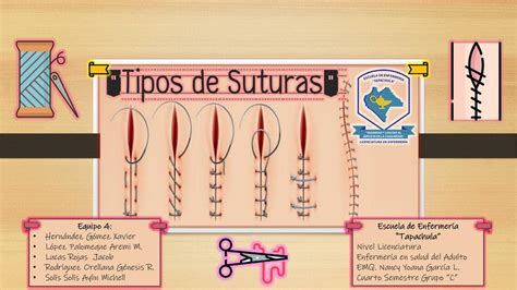 7 Tipos De Suturas Que Todo Estudiante Debe Conocer Tipos De Suturas