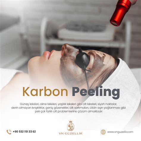 Karbon Peeling Nedir Nasıl Uygulanır Etkileri Nelerdir Liva