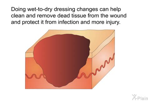 PatEdu Wet To Dry Dressing Changes For Pediatrics