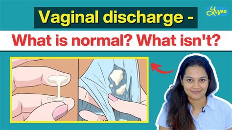 Vaginal Discharge What Is Normal What Is Not ThatSexEdTalk YouTube